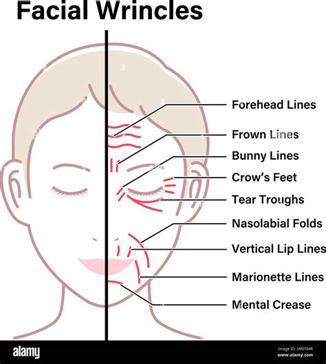 Facial Wrinkles Female Face Vector Illustration Stock Vector Image Art Alamy