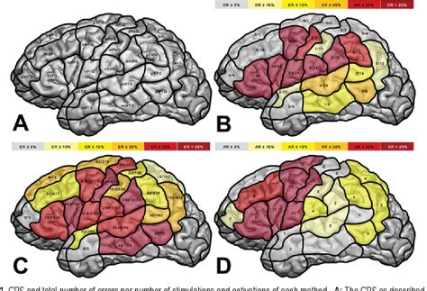 Figure 1 From Combined Noninvasive Language Mapping By Navigated Transcranial Magnetic