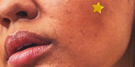 How To Get Rid Of Pimples Under The Skin POPSUGAR Beauty