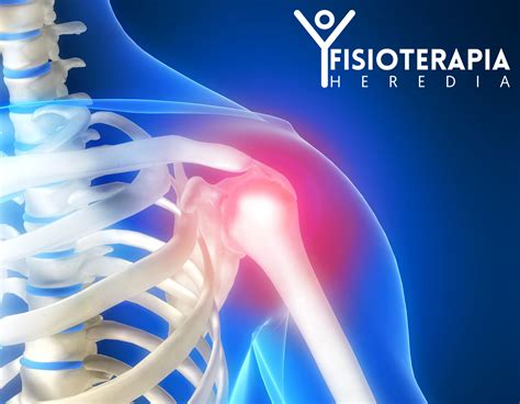 Lesiones De Hombro Cuáles Son Las Más Comunes Y Cómo Tratarlas Mvfg