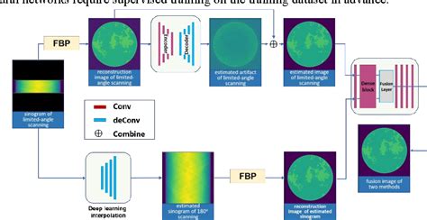 Figure 1 From Sparse View Ct Reconstruction Based On Fusion Learning In Hybrid Domain Semantic
