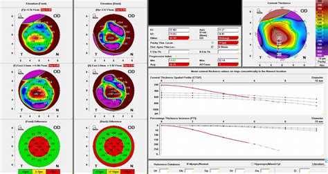 Pentacam Rainbow Optometry
