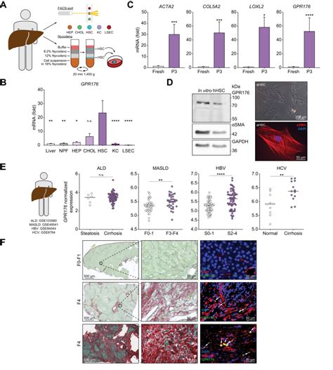 Orphan Receptor Gpr176 In Hepatic Stellate Cells Exerts A Profibrotic Role In Chronic Liver