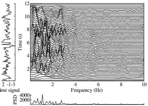 Tf Representation Using Mbd Of Eeg Non Seizure Download Scientific Diagram