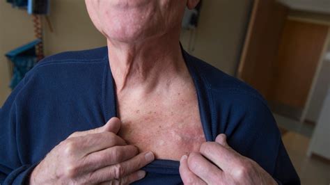 Implantable Cardioverter Defibrillator Vs Pacemaker