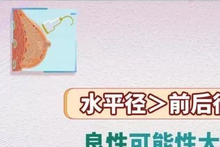 结节拉力和直线拉力区别