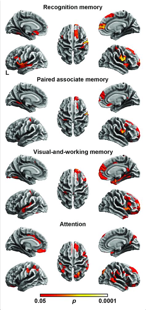 Brain Regions With A Positive Correlation Between Cortical Fractal Download Scientific