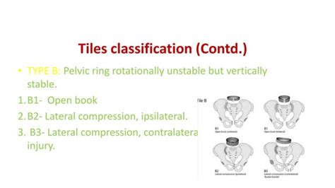 Classification Of Pelvic Fracture Pptx