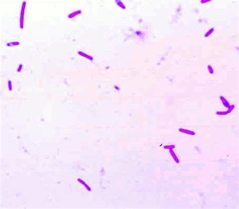 Clostridium Botulinum Culture Gram Stain In Cows Bovis Vetlexicon