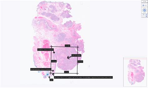 Ngi Sweden Visium Hd Probe Based Ffpe Samples