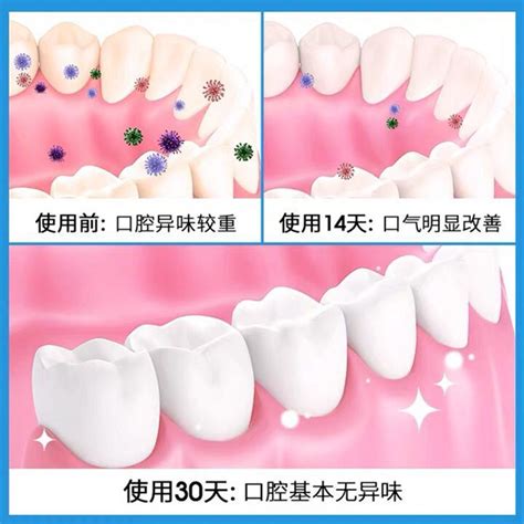 仁和牙齿去黄去烟渍茶渍男女通用牙黄神器买5送5 虎窝淘