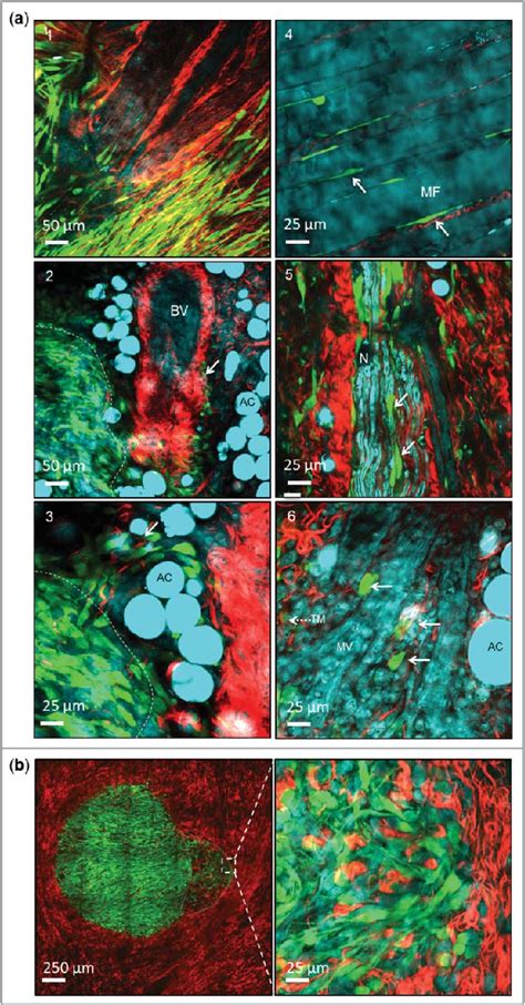 Figure 1 From Explorer In Vivo Imaging Of The Tumor And Its Associated