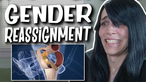 Gender Reassignment Surgery Buffalo Ny At Herschel Phipps Blog