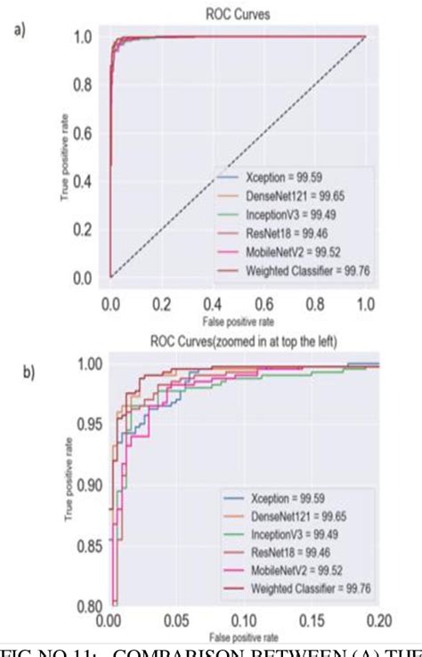 Figure 10 From A Deep Feature Learning Model For Pneumonia Detection