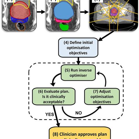 Pdf Automation In Intensity Modulated Radiotherapy Treatment Planning A Review Of Recent