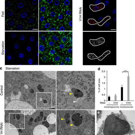 Endosome Maturation Autophagosome Formation And Fusion With Lysosome Download Scientific