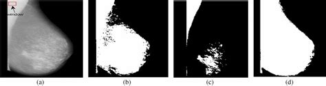 Binary Images Obtained After Applying Different Threshold Values A Download Scientific Diagram