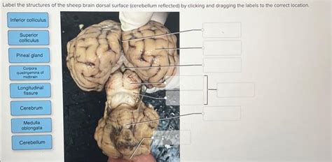 Label The Structures Of The Sheep Brain Dorsal