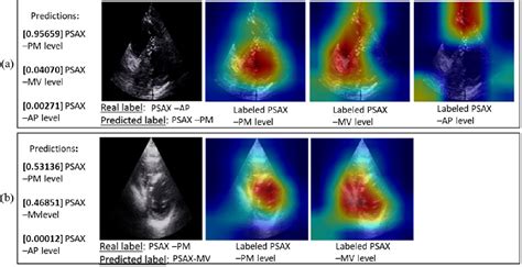 Figure 2 From Classification Of Echocardiogram View Using A