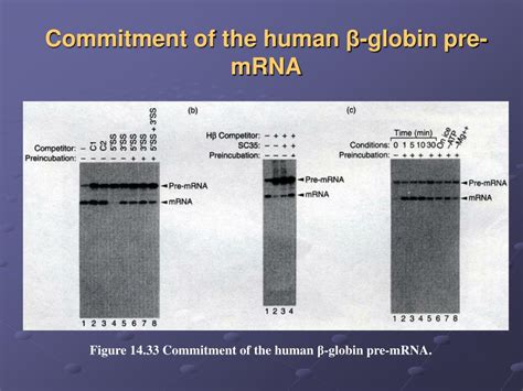 Ppt Micrograph Of Human Pre Mrna Splicing Factor In A Cell Nucleus