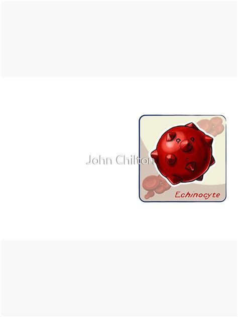 Echinocyte Echinocyte Metal Print For Sale By John Chilton