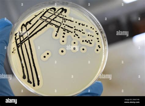 A Quadrant Streak Of The Bacterium Staphylococcus Aureus Cultured Or Inoculated On A Baird