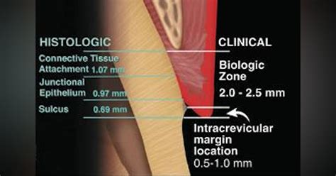 Impressive Results Dentistry Iq