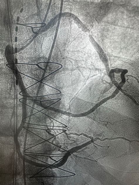 Sridhar Sampath Kumar On Linkedin Guideliner Highriskpci