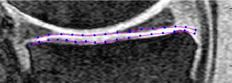 Segmentation Using Original Asm Method Download Scientific Diagram