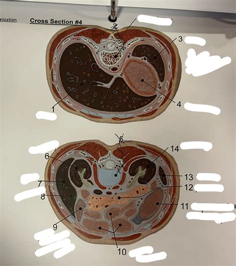A P LAB Cross Sectional 4 Diagram Quizlet