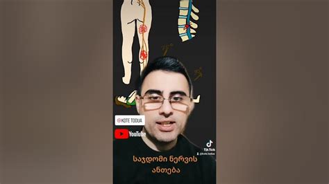 საჯდომი ნერვის ანთება ცალი ფეხის ტკივილი იშიაზი Youtube