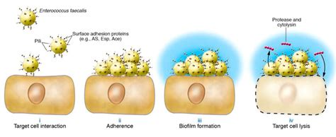 Enterococcus Faecalis Infection