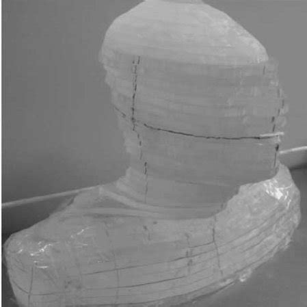 Anatomical Perspex Head And Neck Phantom For The Verification Of Download Scientific Diagram