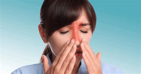 Acupuncture For Sinuses Natural Relief That Works