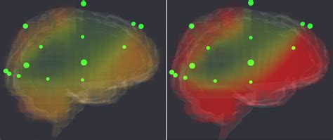 Brain Source Localization Of Participant 1 Before And After Conducting