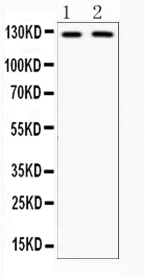 Cd11b Polyclonal Antibody Invitrogen 100 μg Unconjugatedantibodies