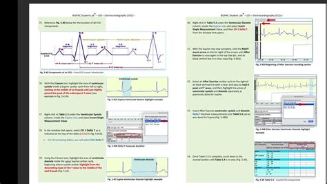 Ecg Data Analysis Video Youtube