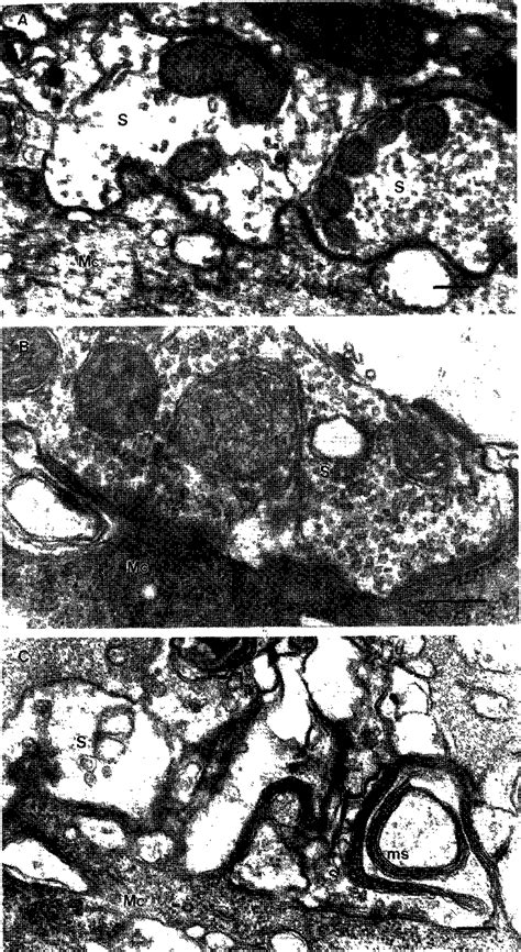 Figure 1 From Ultrastructure Of Mauthner Cells In Fish Adapted To Long
