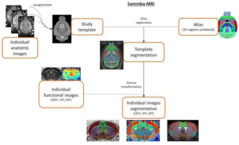 Automated Co Registration And Segmentation Pipeline Using In House