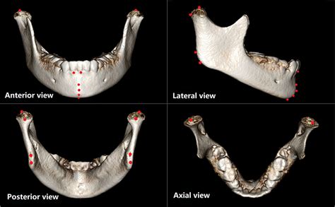 Landmarks Displayed In The 3d Virtual Surface Model Download Scientific Diagram