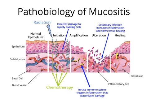 Mucositis Pathophysiology