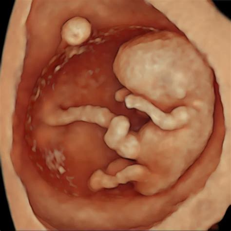 Fetus Definition And Examples Biology Online Dictionary