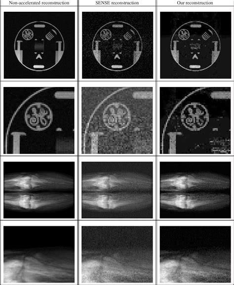 Figure 1 From A Graph Cut Algorithm For Generalized Image Deconvolution Semantic Scholar