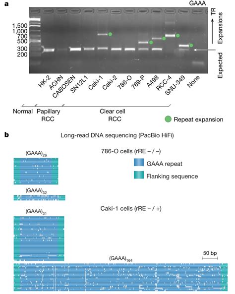 Nature 大规模分析癌症基因组中的重复序列扩增 企业官网