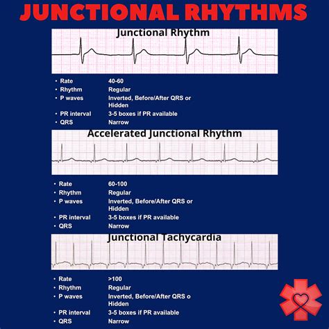 Junctional Rhythms