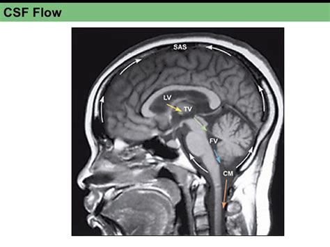 The Central Nervous System Ppt Video Online Download