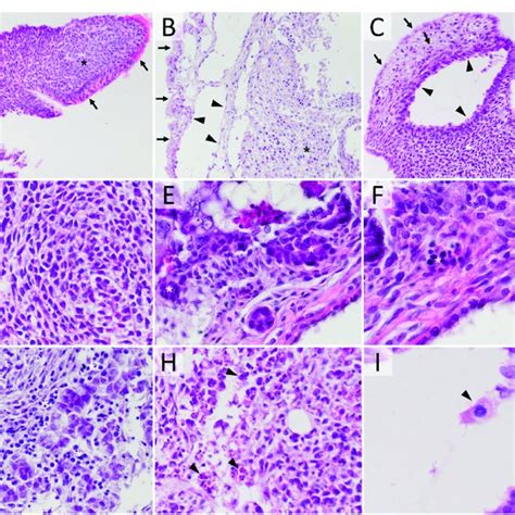 Experimental Mouse Teratoma Morphology A Teratoma Consisting Mostly Download Scientific