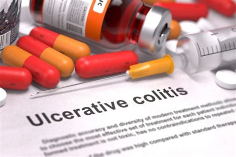 Colitis Facty Health