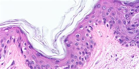 Repair Soft Tissue Defects Innovative Regenerative Treatment