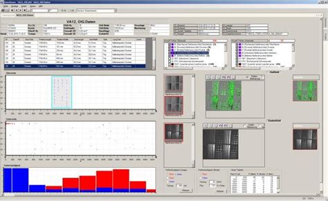 Visualisation Of A Reference Coil Detection Result Download
